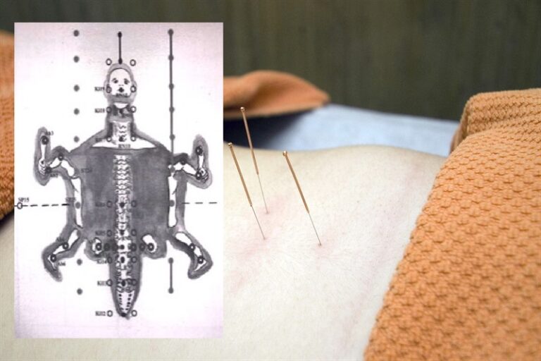 Abdominal Acupuncture – Lavender House Acupuncture & Wellness Clinic